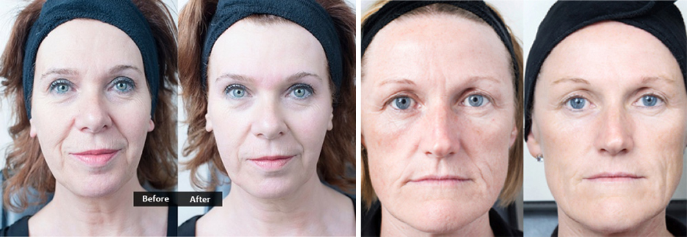 Crystal Clear Facial – Mirage Beauty